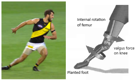 Alex Rance does ACL in first match of the season - Hawthorn ...